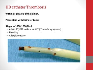 Temporary vascular access for hemodialysis | PPTX