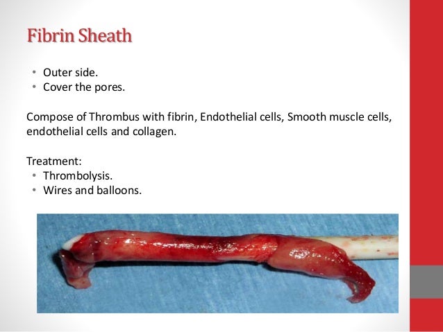 Temporary vascular access for hemodialysis