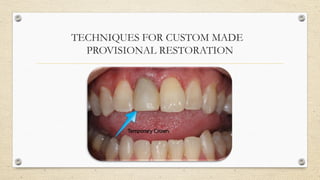 temporization in fixed partial denture prosthodontics | PPT