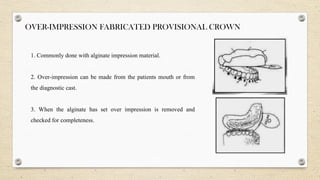 temporization in fixed partial denture prosthodontics | PPT