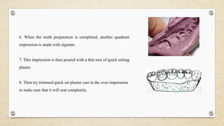 temporization in fixed partial denture prosthodontics | PPT