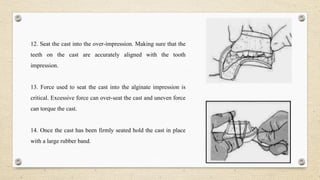 temporization in fixed partial denture prosthodontics | PPT