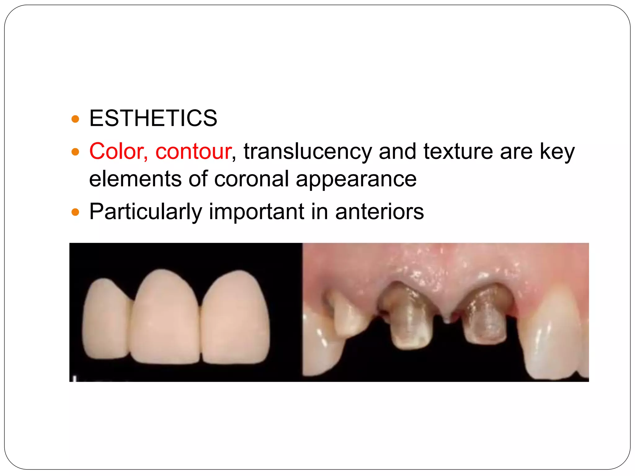 Temporization in fixed prosthodontics | PPTX