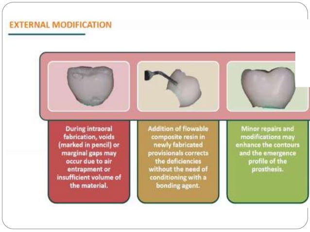 Temporization in fixed prosthodontics | PPTX