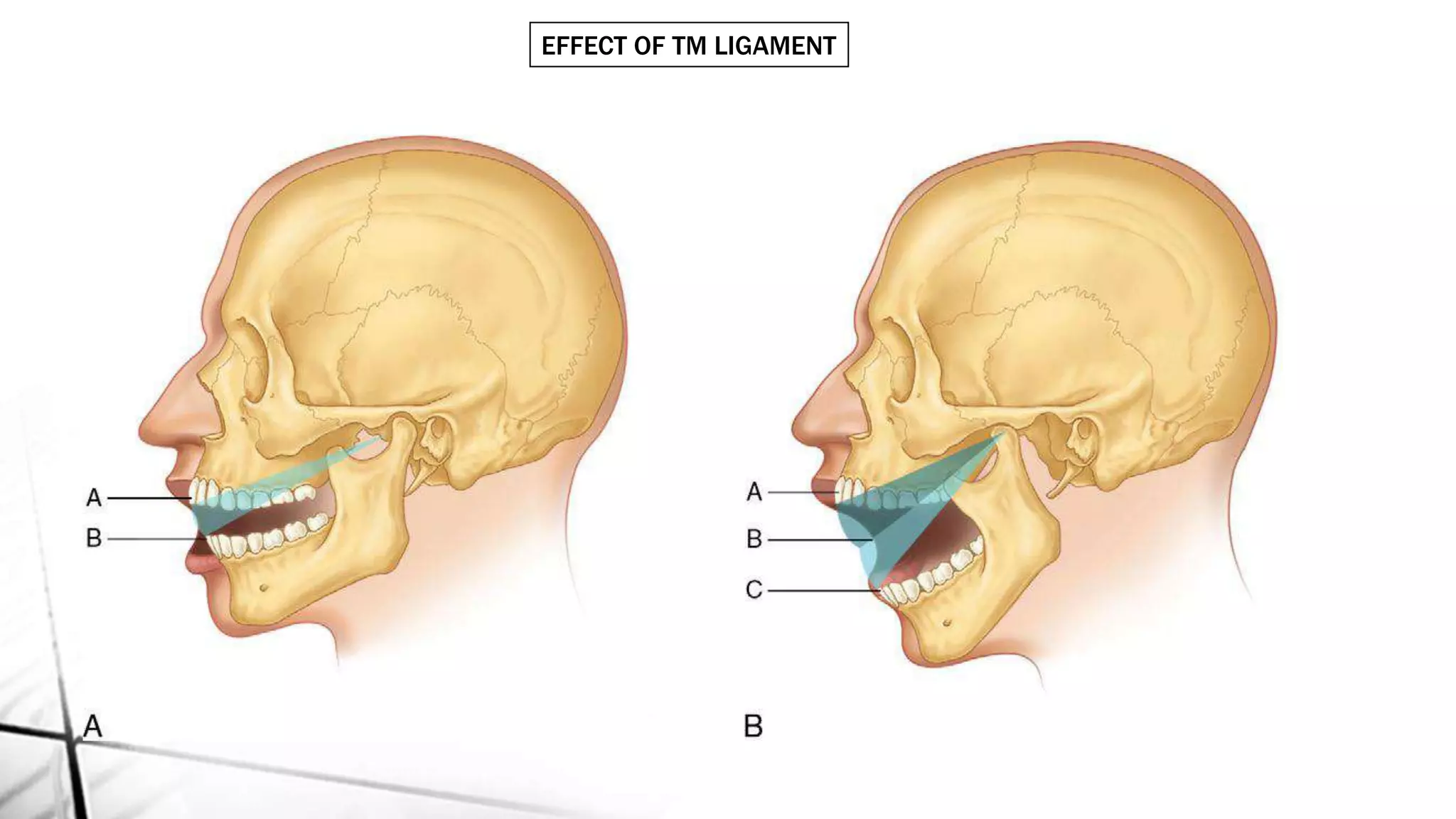 Tempormandibular disorders & orthodontics | PPTX