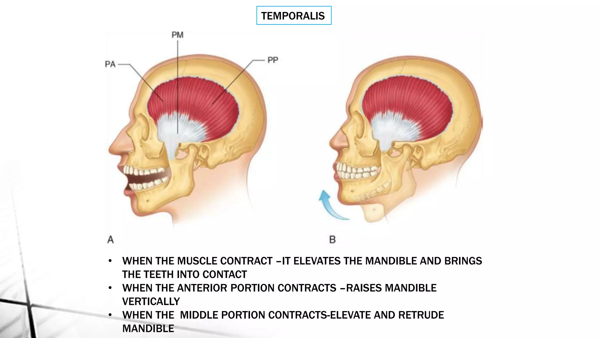 Tempormandibular disorders & orthodontics | PPTX