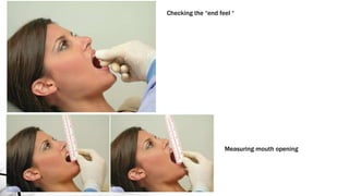 Tempormandibular disorders & orthodontics | PPTX