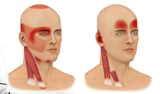 Tempormandibular disorders & orthodontics