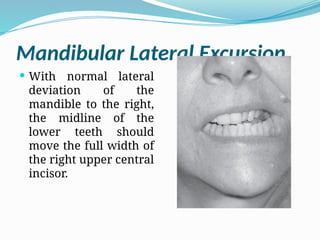 TEMPOROMANDIBULAR JOINT DISORDERS ...... | PPTX