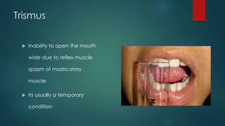 Temporomandibular disorders | PPTX