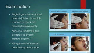 Temporomandibular disorders | PPTX