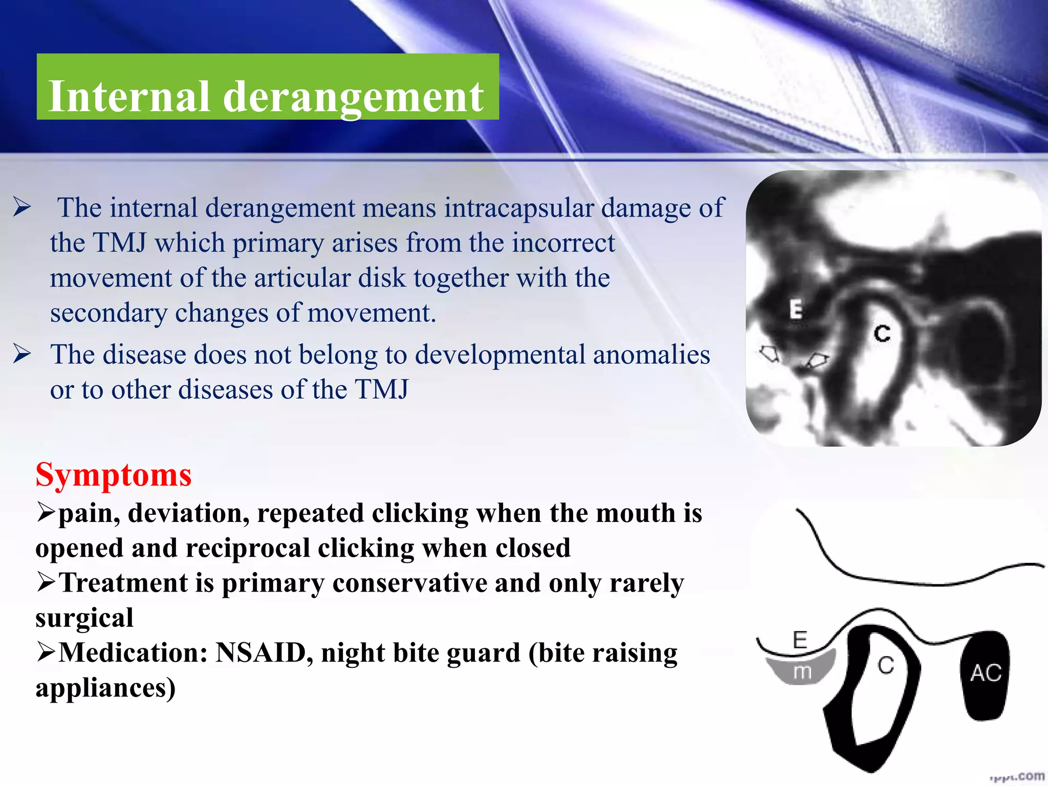 Temporomandibular disorders.pptx