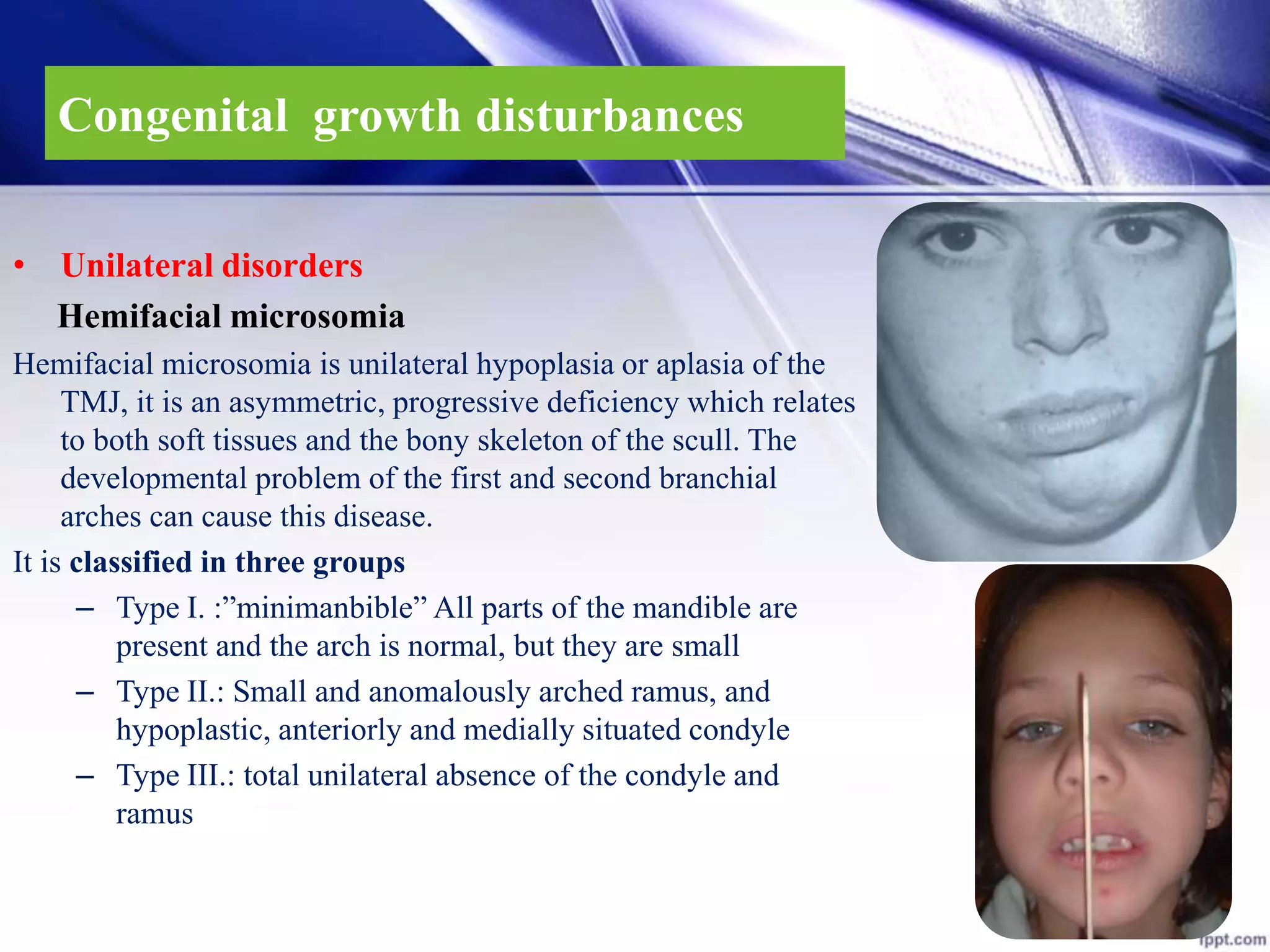 Temporomandibular disorders.pptx