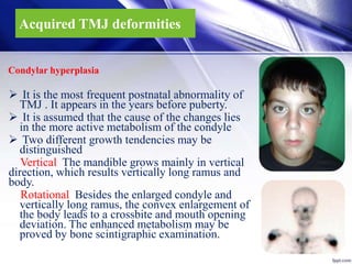 Temporomandibular disorders.pptx