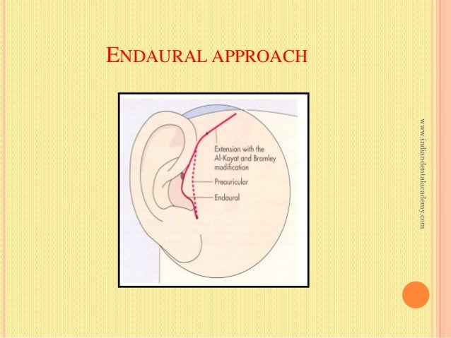 Temporomandibular joint /certified fixed orthodontic courses by Indi…