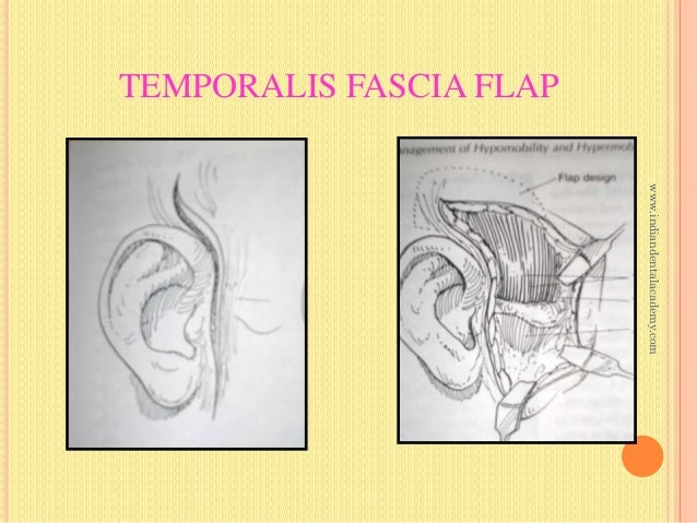 Temporomandibular joint /certified fixed orthodontic courses by Indi…
