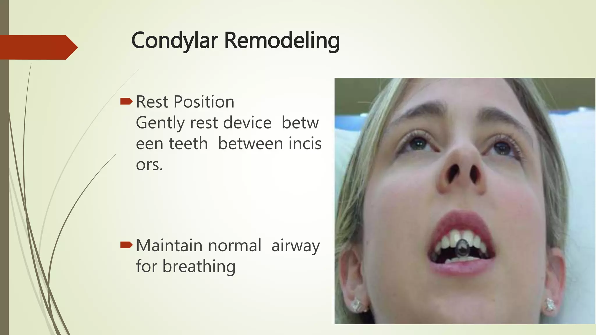 Temporomandibular joint /disorders /management / treatment | PPTX