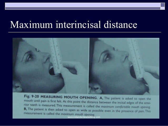 Temporomandibular joint/ dental courses