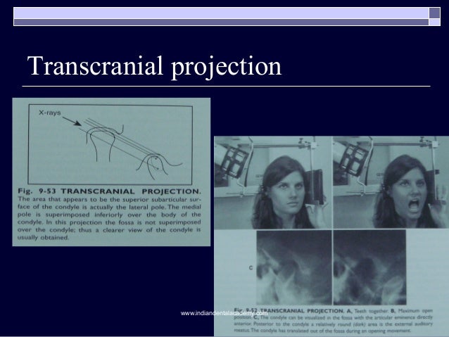 Temporomandibular joint/ dental courses