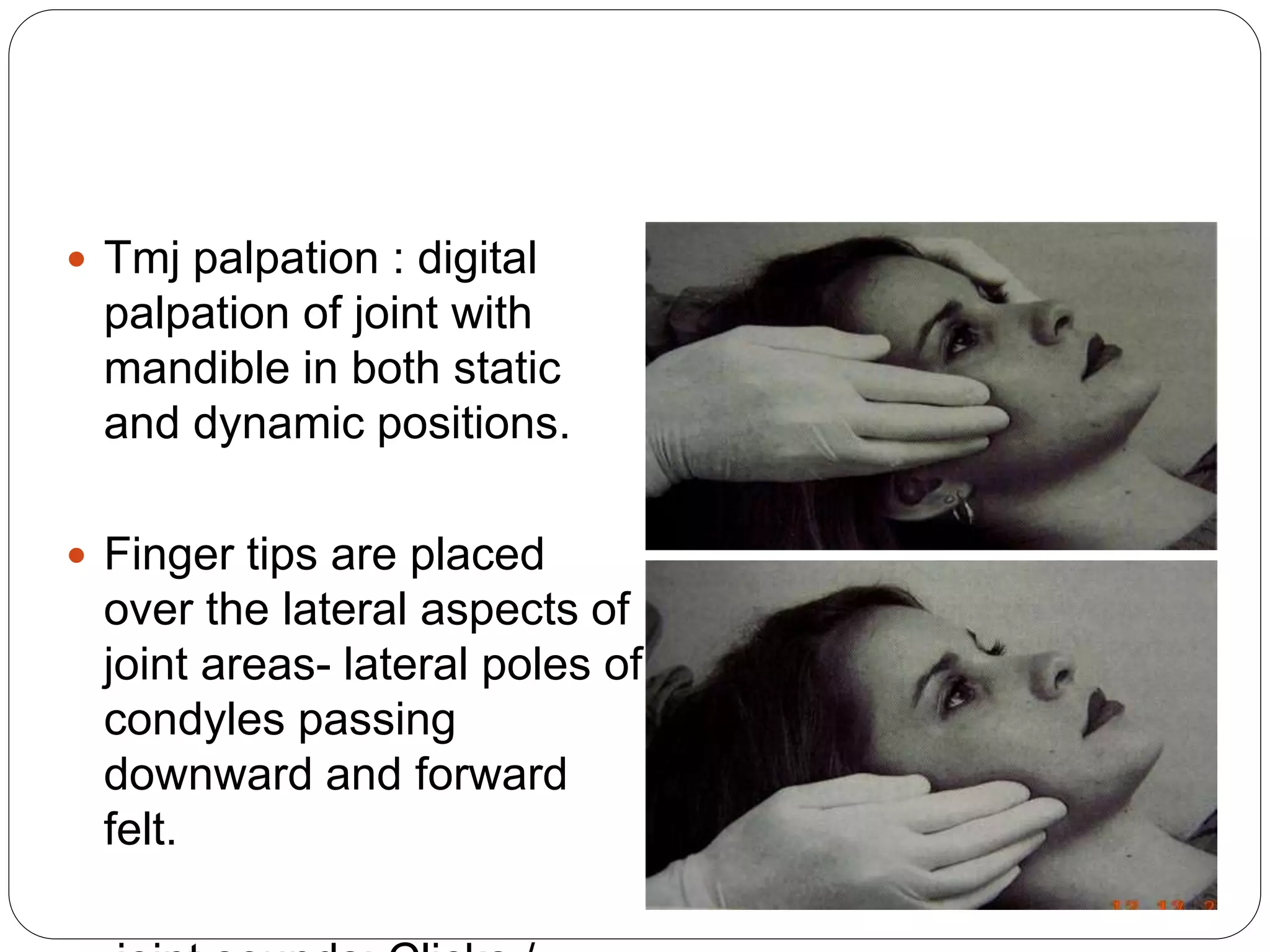 Temporomandibular joint | PPTX