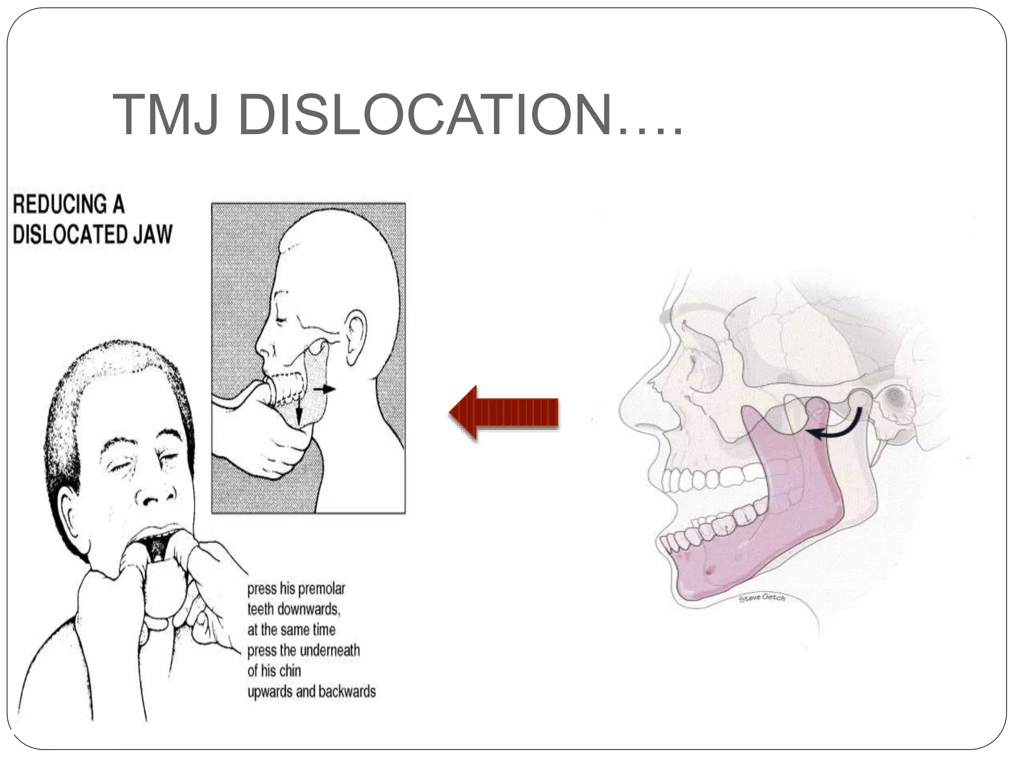 Temporomandibular joint | PPTX