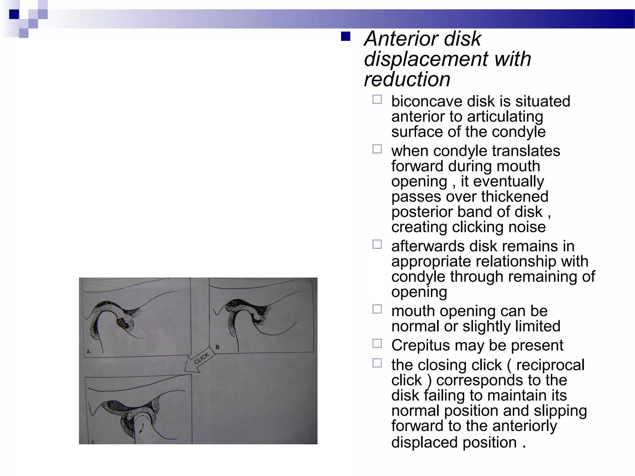 Temporomandibular joint | PPT