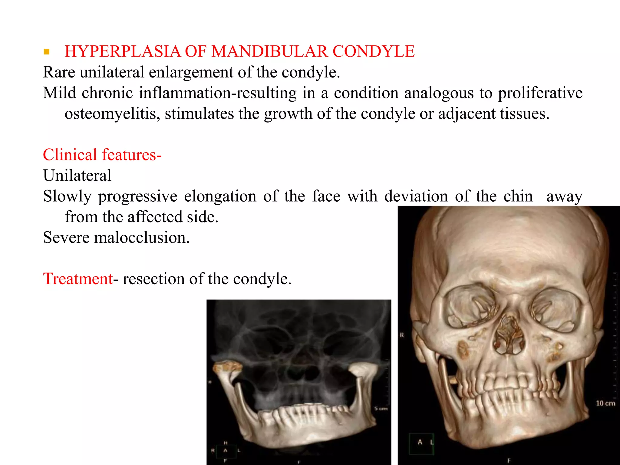 Temporo mandibular joint | PPTX