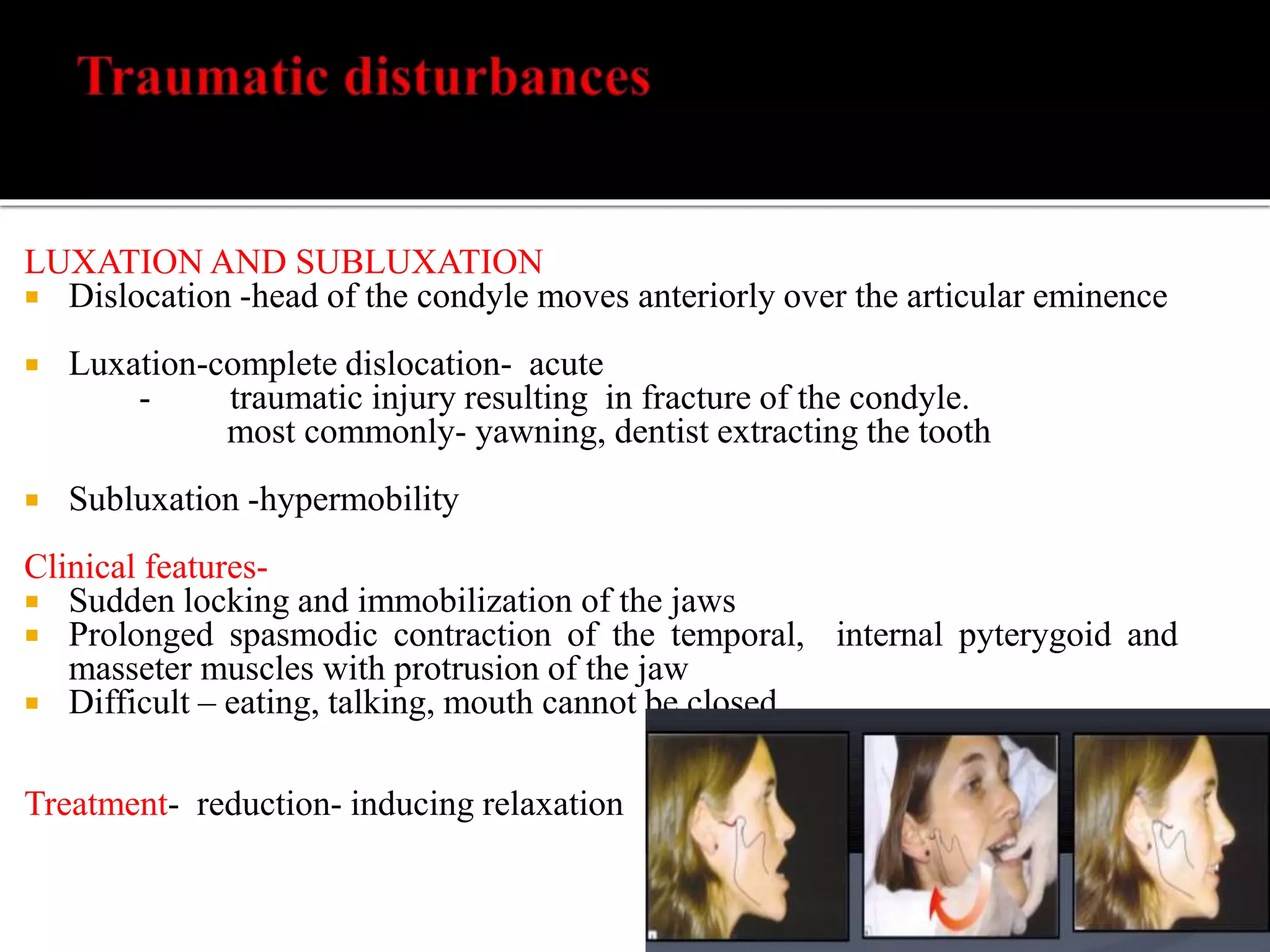 Temporo mandibular joint | PPTX