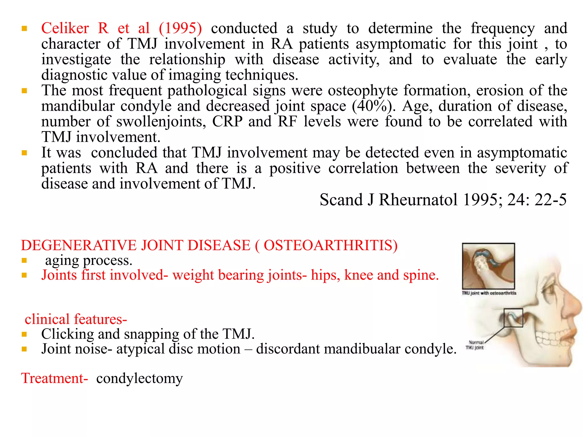 Temporo mandibular joint | PPTX