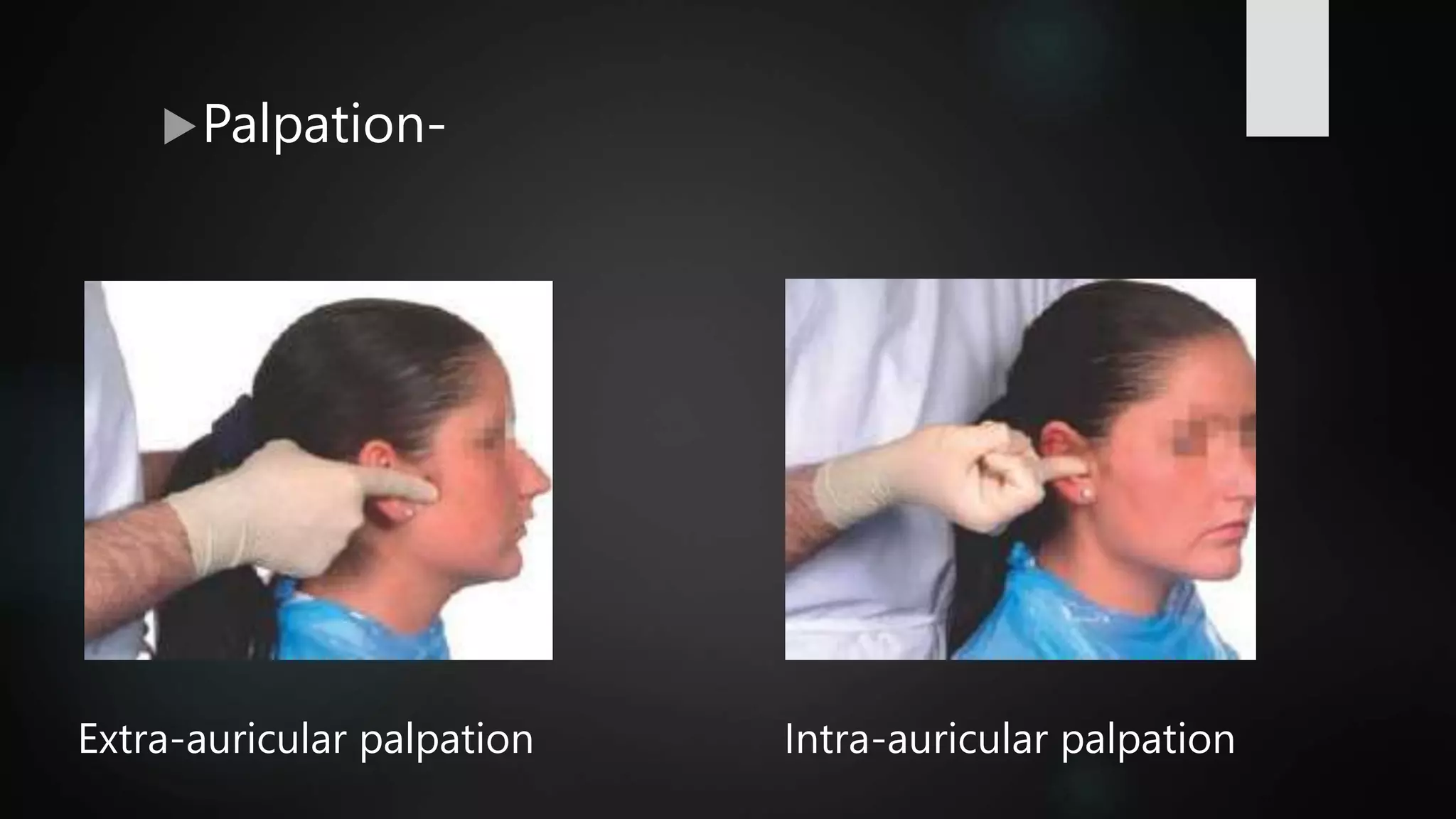 temporomandibular joint.pptx