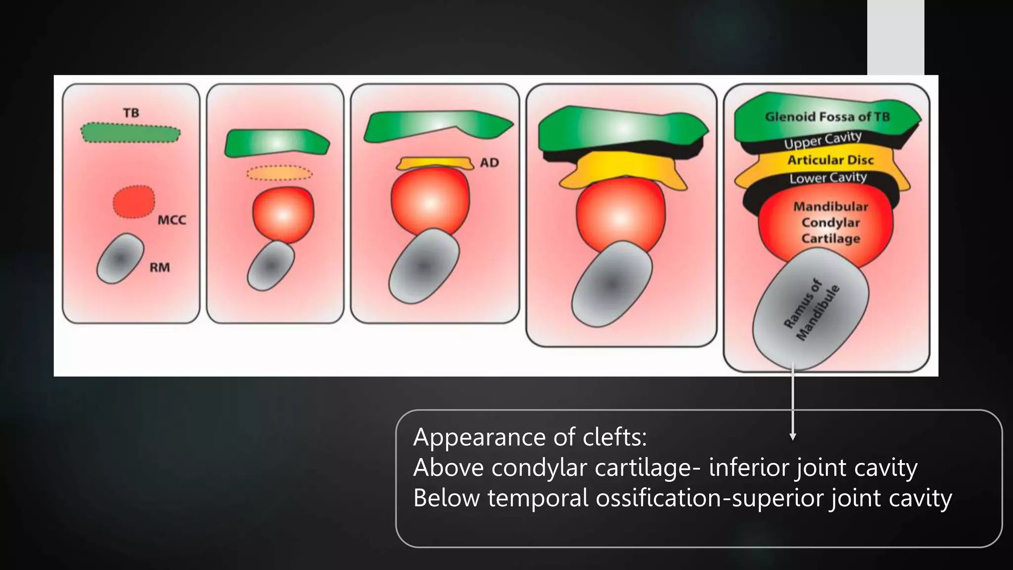temporomandibular joint.pptx