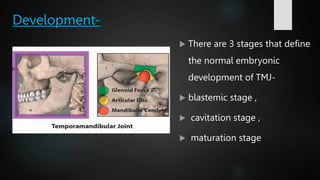 temporomandibular joint.pptx