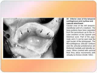ANATOMY TEMPOROMANDIBULAR JUNCTION OF HUMAN | PPTX