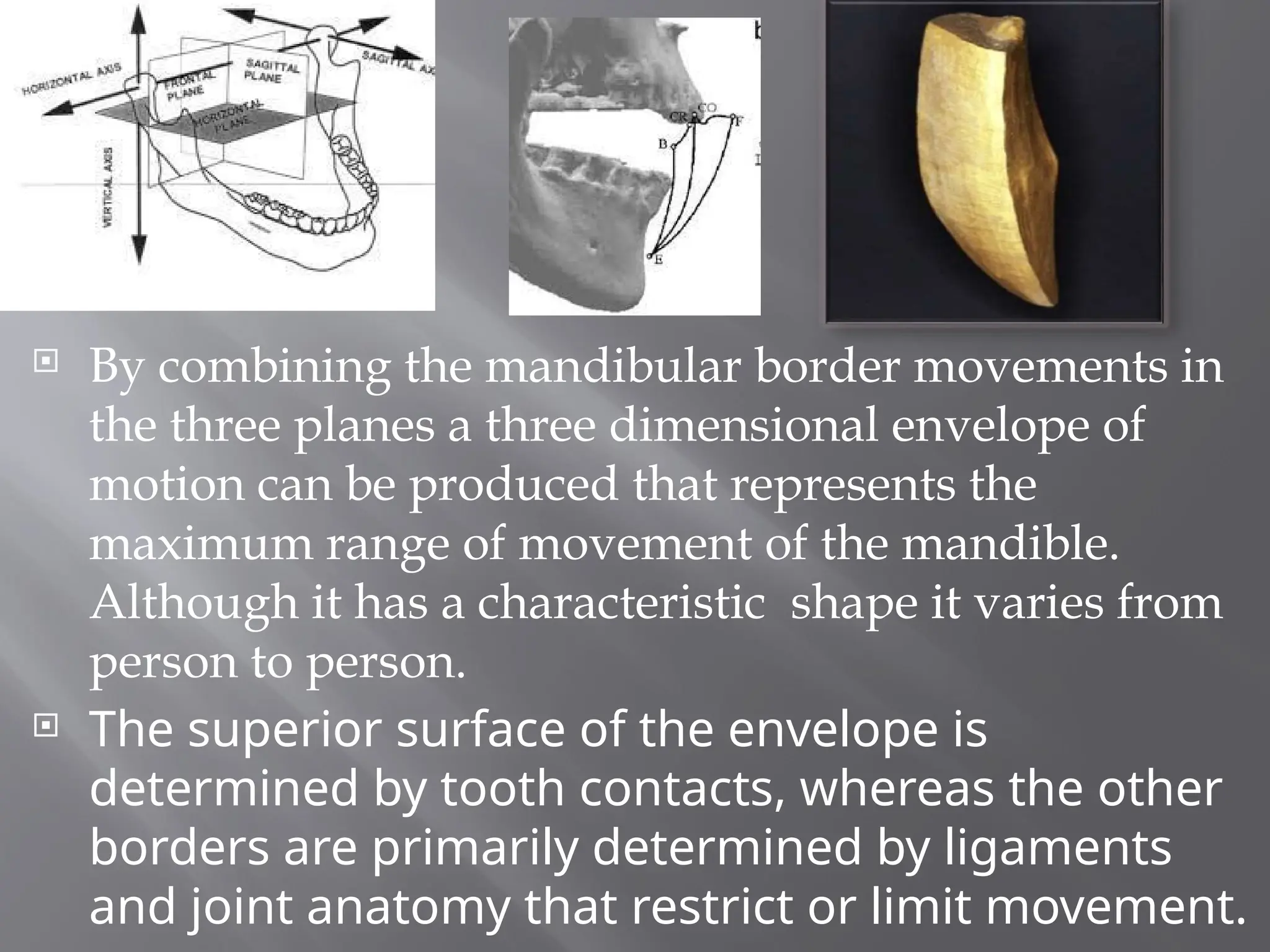 Temporo mandibular joint and its disorders | PPTX