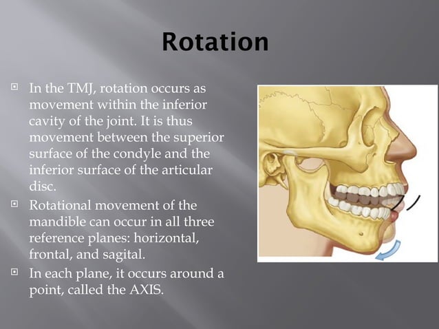 Temporo mandibular joint and its disorders | PPT
