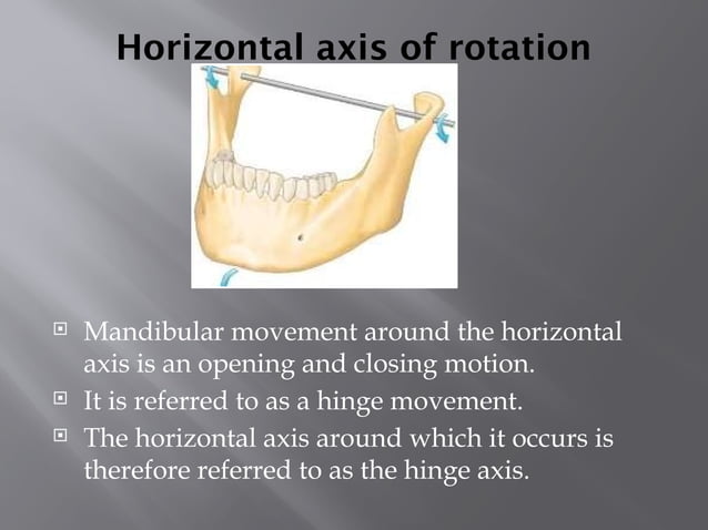 Temporo mandibular joint and its disorders | PPT