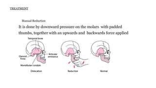 TEMPOROMANDIBULAR JOINT.pptx PERIODONTICS | PPTX