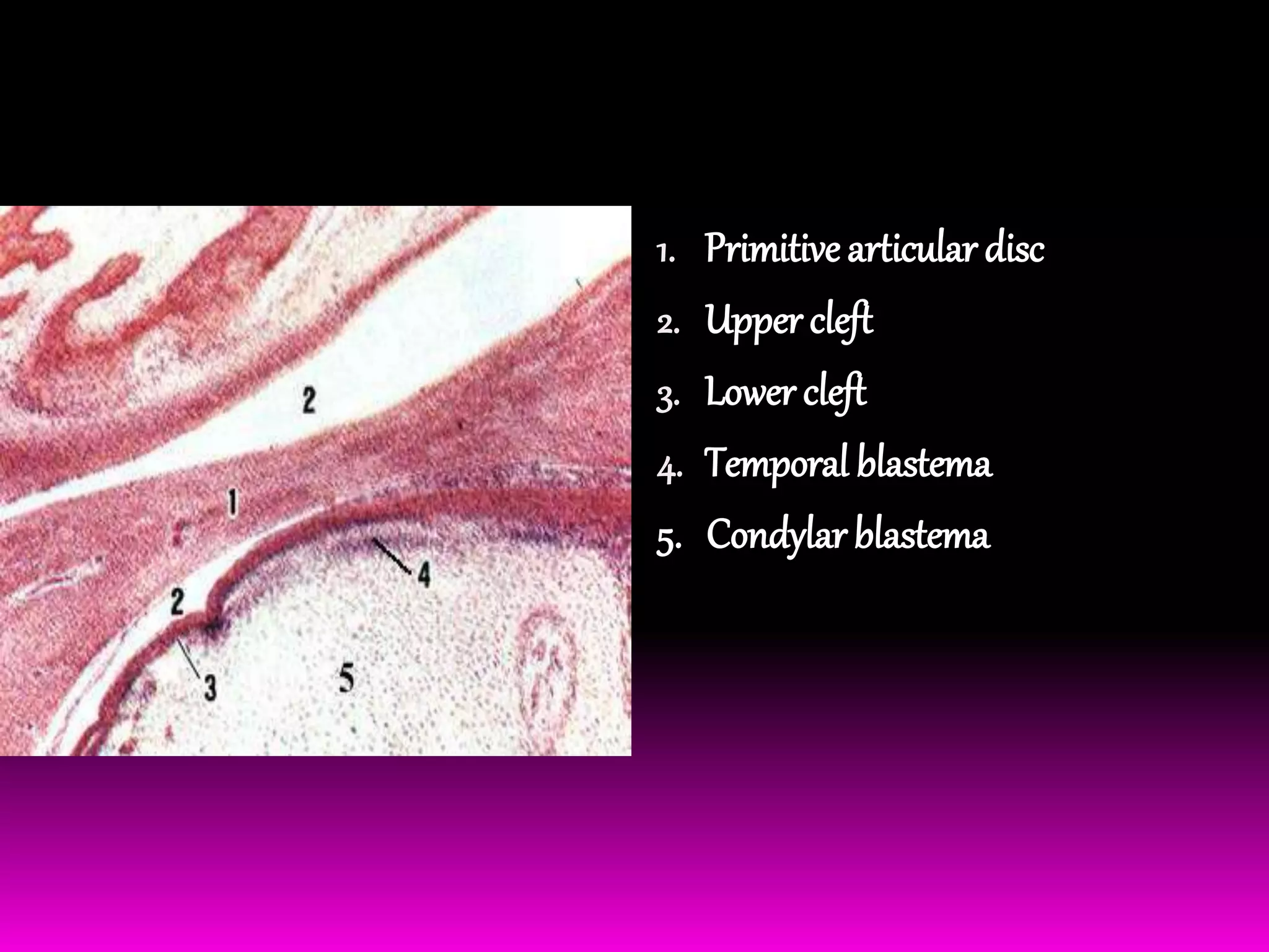Temporomandibular joint anatomy and its prosthodontic implications | PPTX