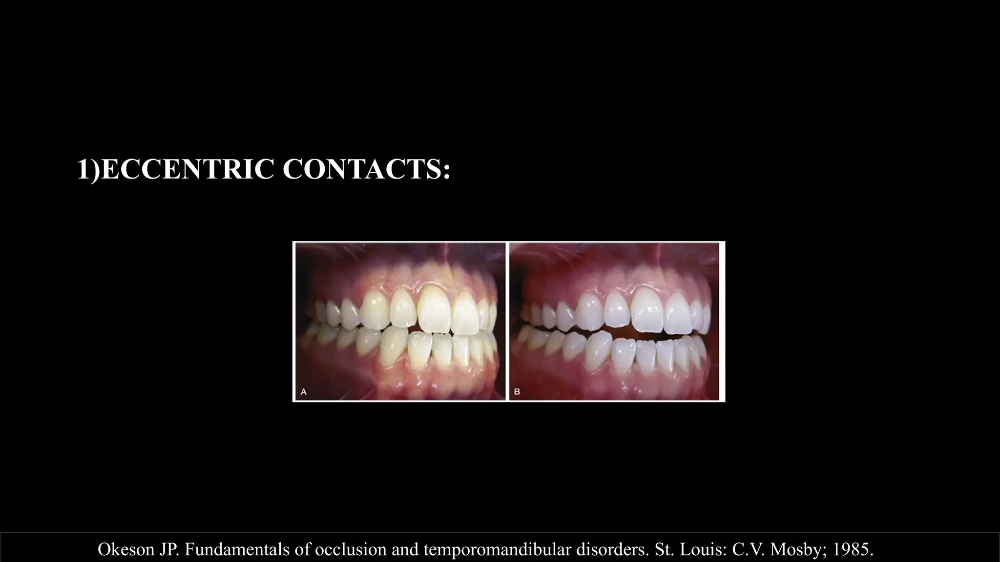 TEMPOROMANDIBULAR JOINT AND MANDIBULAR MOVEMENTS PPT.pptx