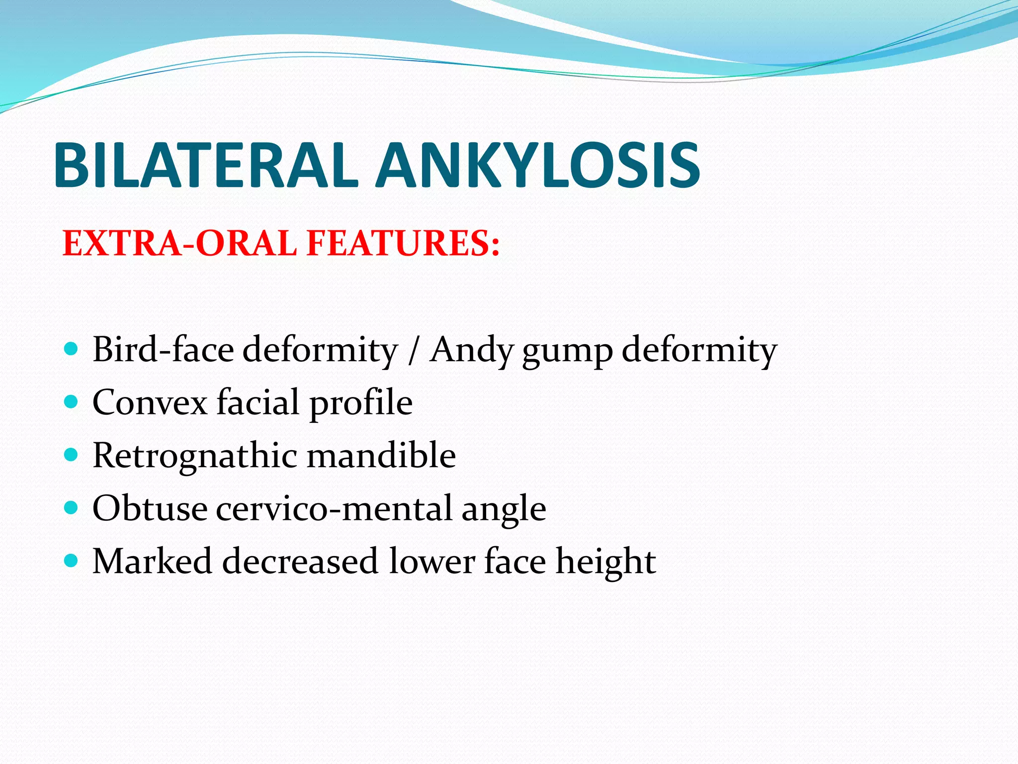 Temporomandibular joint ankylosis | PPTX