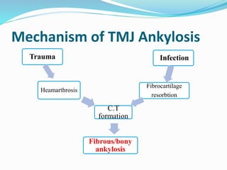 Temporomandibular joint ankylosis | PPTX