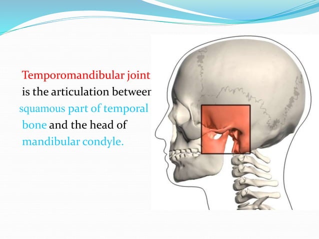 Temporomandibular joint ankylosis