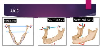 TEMPOROMANDIBULAR JOINT BIOMECHANICS.pptx