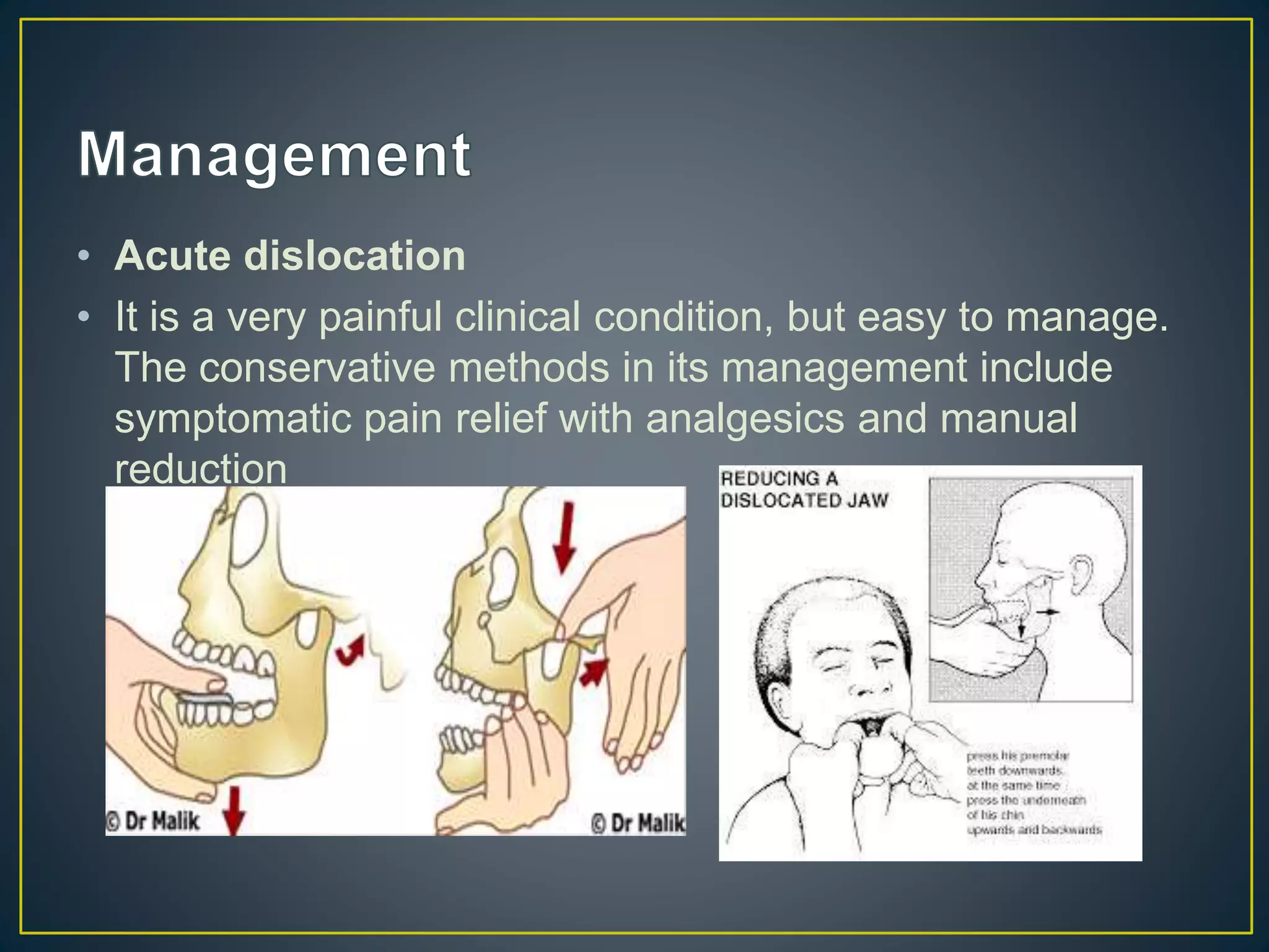 Temporomandibular joint dislocation | PPTX