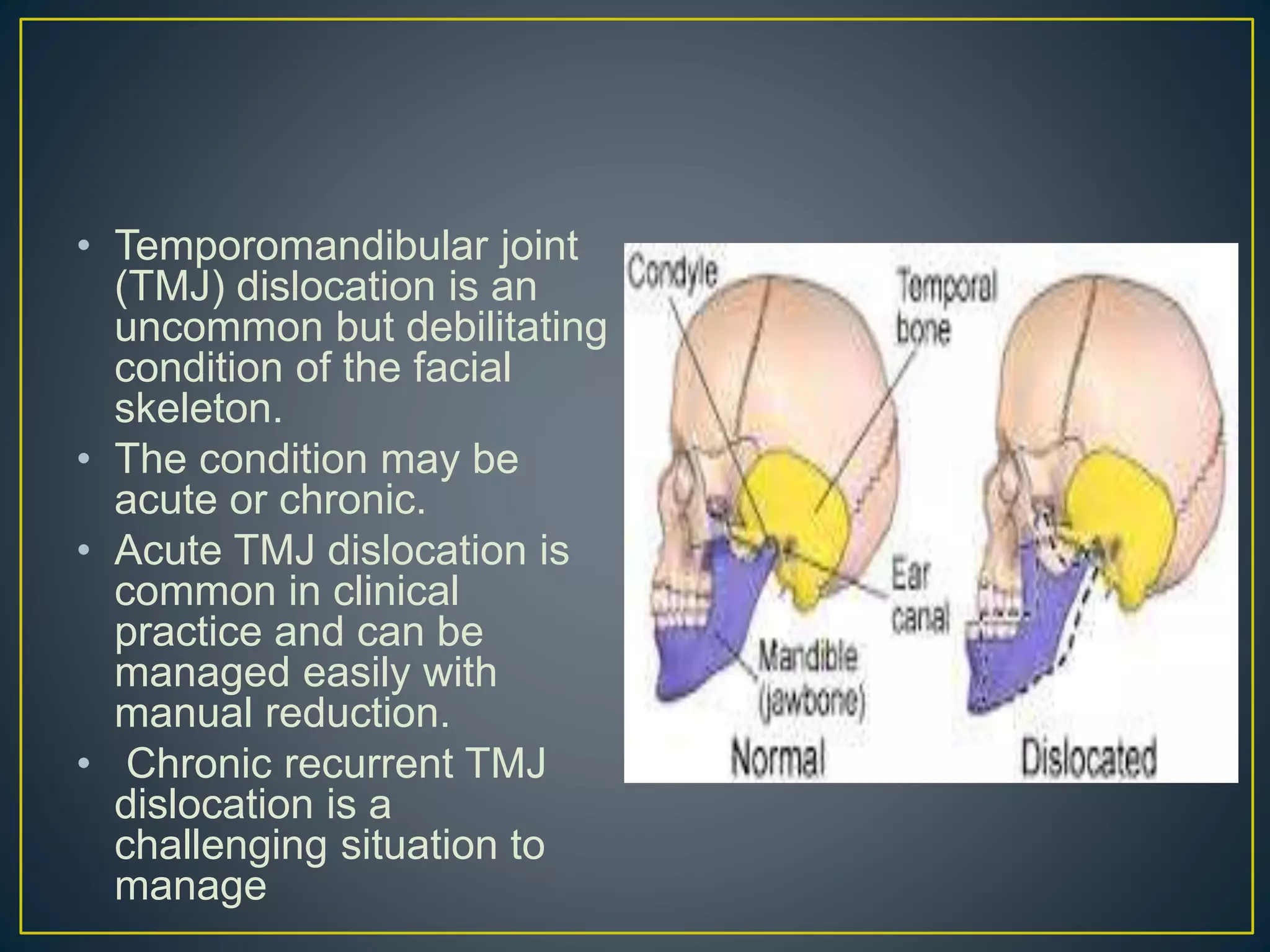 Temporomandibular joint dislocation | PPTX