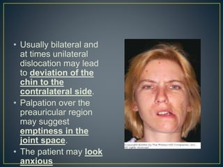 Temporomandibular joint dislocation | PPTX