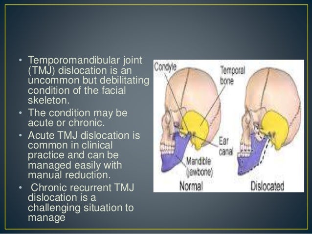 Temporomandibular joint dislocation