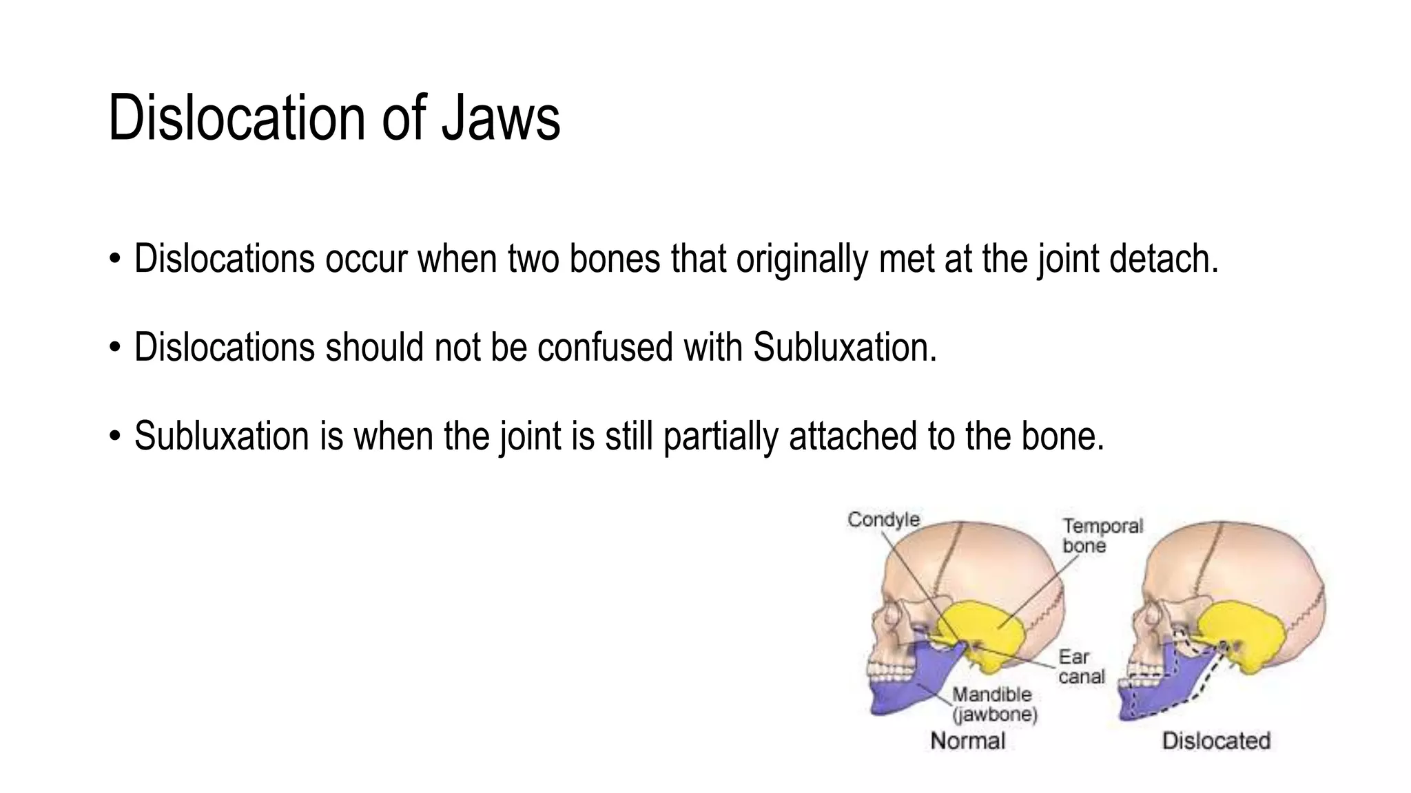 Temporomandibular joint dislocation | PPTX