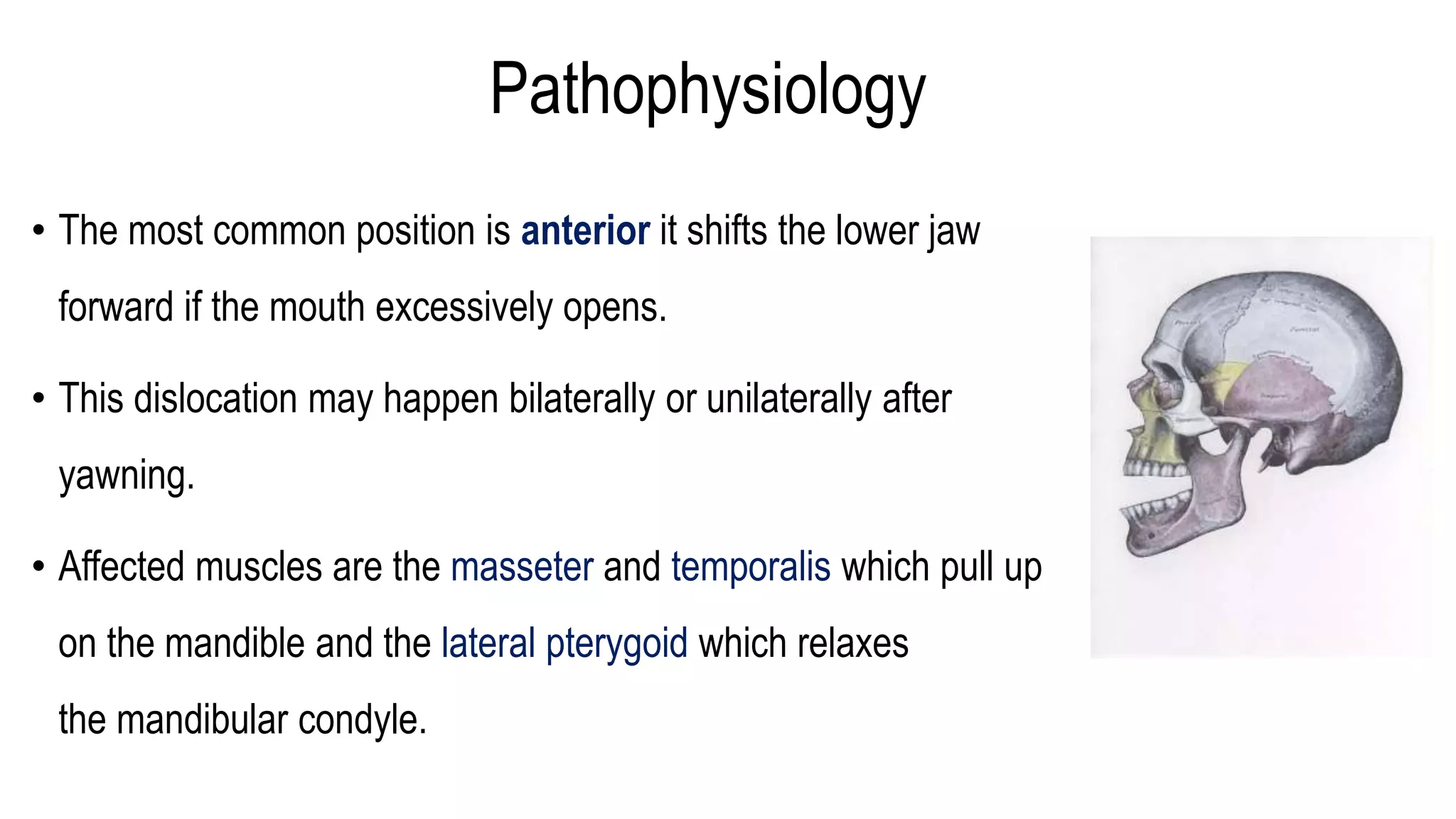 Temporomandibular joint dislocation | PPTX
