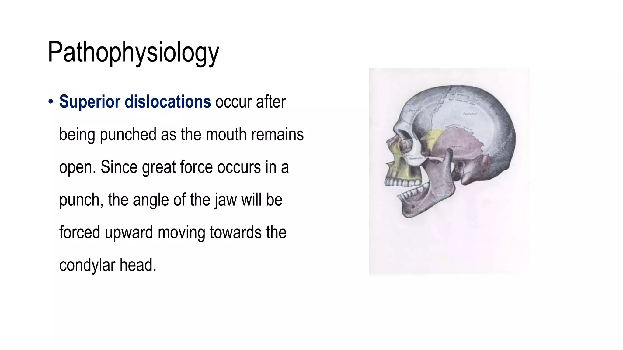 Temporomandibular joint dislocation | PPTX